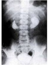 Hoefijzernier - Pagina's [1] - Wereld encyclopedische kennis